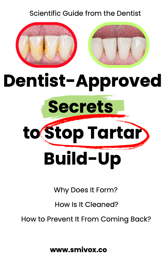 Dentist-Approved Secrets to Stop Tartar Build-Up E-book – SmiVox
